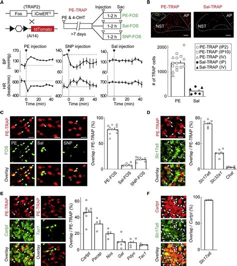 Cardiovascular Baroreflex Circuit Moonlights In Sleep Control Neuron