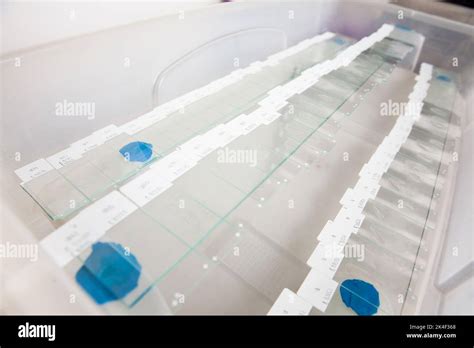 Scientist Preparing Slides With Paraffin Embedded Tissue Samples For Immunohistochemistry Assay