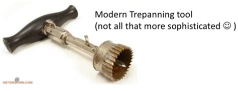 71 Brain Dysfunction Flashcards Quizlet 71 Brain Dysfunction Flashcards Quizlet