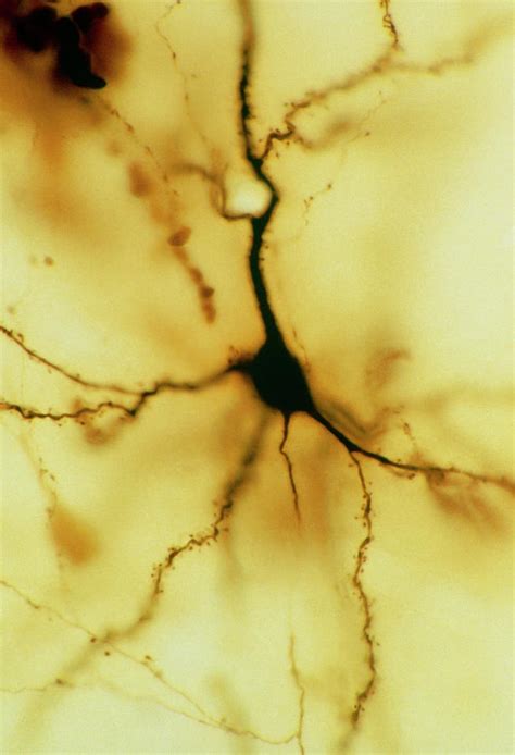 Light Micrograph Of A Pyramidal Neuron Photograph By Douglas And Martin