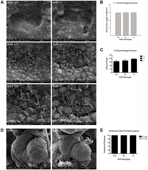 Arf4 Mutant Mice Have Functional Nodal Cilia A Sem Of 34 Somite