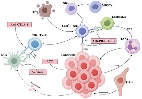 Eric Zhang On Linkedin Intrahepatic Cholangiocarcinoma