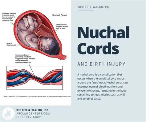 Octuplos No Utero Fotos Gestações Múltiplas Casos Que Ganharam
