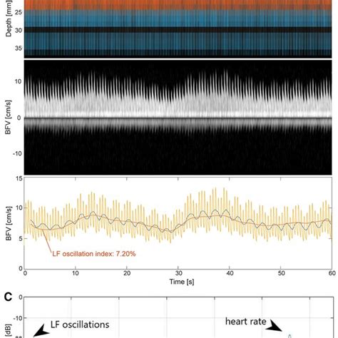 The Relationship Between Arterial Low Frequency Oscillations And Download Scientific Diagram