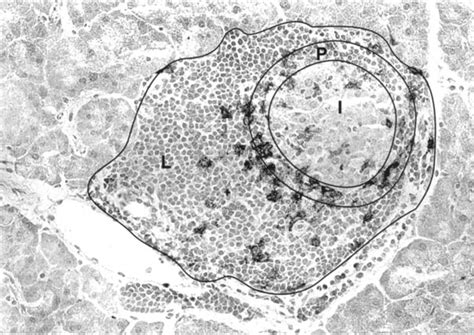 The Location Of Cd11c Dc Black Staining And Lymphocytes In Islet