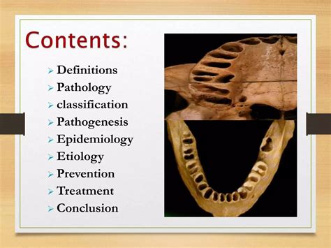 Residual Ridge Resorption Pptx