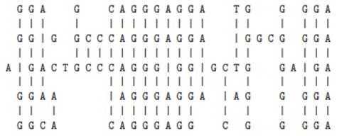 The Sp Multiple Alignment Concept As A Generalization Of Six Other