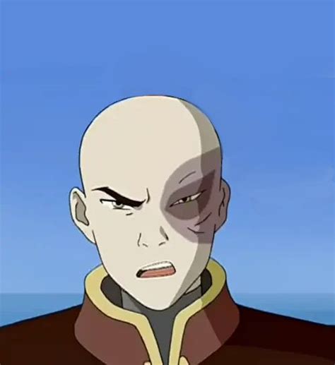 Zuko Bald 😭