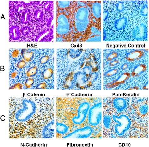 Proliferative Endometrium Histology