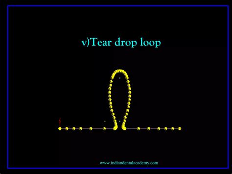 A Comparative Analysis Of Commonly Used Retraction Loops Ppt