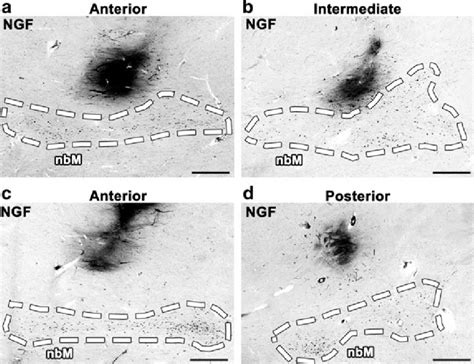 Stereotactic Injection Was Inconsistent No Injections Spread Directly Download Scientific