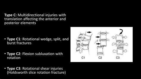Spinal Fractures Classification Core Surgical Trainees Teaching PPTX