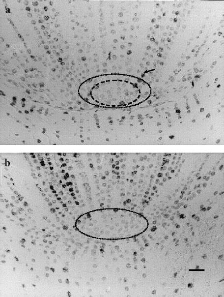 Microphotographs Of Root Cap Cells Starting From The Junction To The Download Scientific