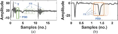 Figure 1 From Localisation Of Partial Discharge In Power Cables Through Multi Output