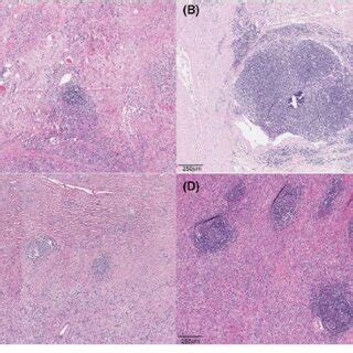 Examples Of Low Maximal TLS Diameter A High Maximal TLS Diameter Download Scientific Diagram