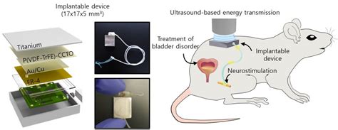 Using Static Electricity To Enhance Biomedical Implants Medical Design Briefs