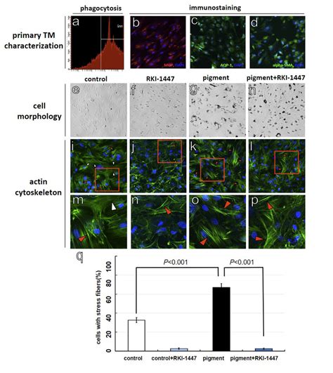 Primary Tm Characterization Cell Morphology And Actin Cytoskeleton