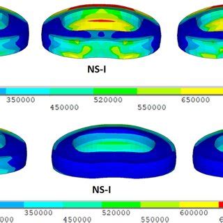 Three Finite Element Spine Models Were Established Intact Spine INT Download Scientific