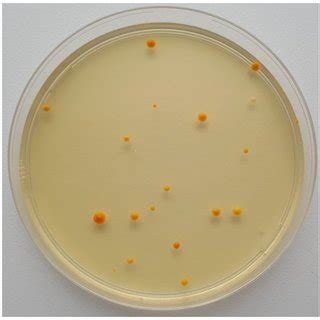 Outline For Yeast Transformation Download Scientific Diagram