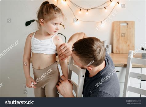 Man Uses Medicine Skin Rash On Stock Photo Shutterstock