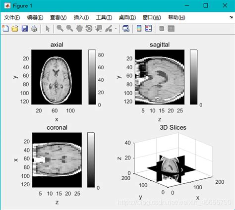 在matlab中可视化3d体积图像数据，例如mri图像volumetric Image File Csdn博客