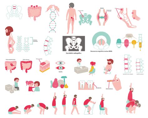 Espondilitis Anquilosante Behance Behance