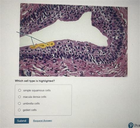 [answered] Which Cell Type Is Highlighted O Simple Squamous Cells Kunduz
