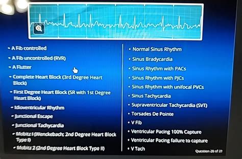 Afib ControlledA Fib Uncontrolled Chegg Com