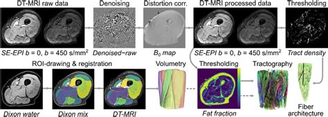 schematic showing the diffusion tensor magnetic resonance imaging