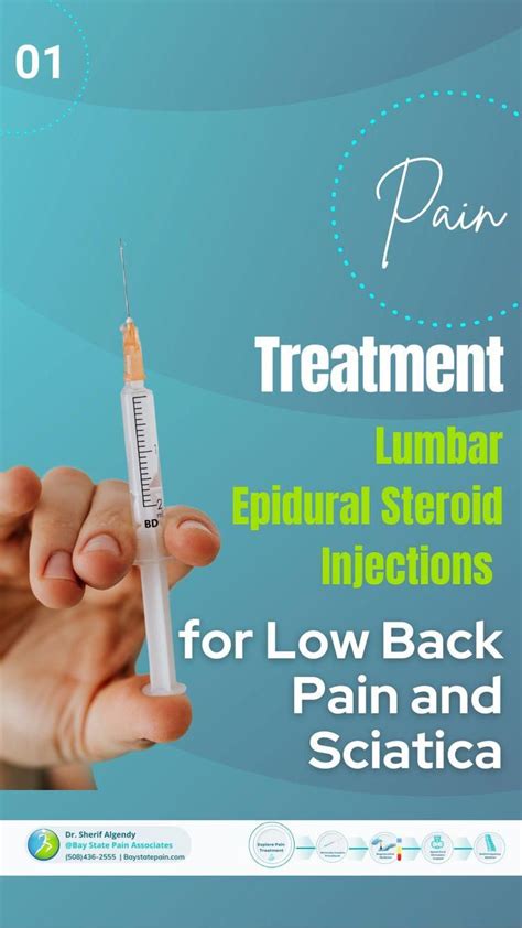 Epidural Injection Artofit