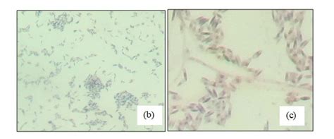 A The Microscopic Morphology Of P Oryzae Obtained B P Oryzae