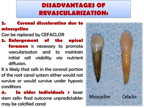 Revascularization Pdf