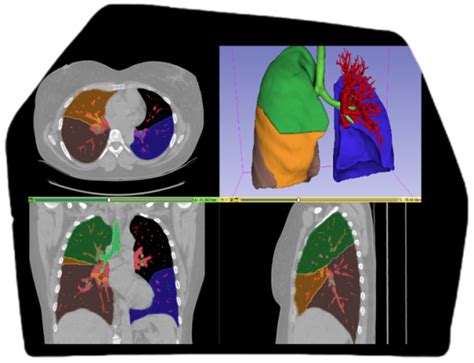 Medical Annotation So Development