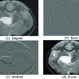 Sample Effects Of Image Preprocessing Download Scientific Diagram