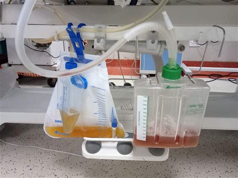 Parts Of Chest Tube Drainage System At Chad Barnes Blog
