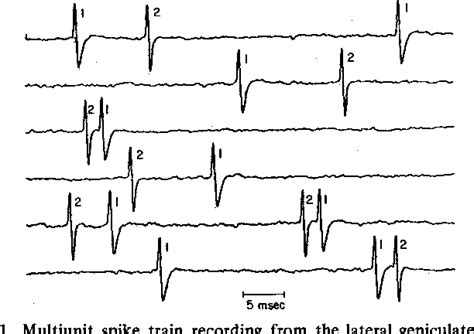 Figure 1 From Real Time Classification Of Multiunit Neural Signals Using Reduced Feature Sets