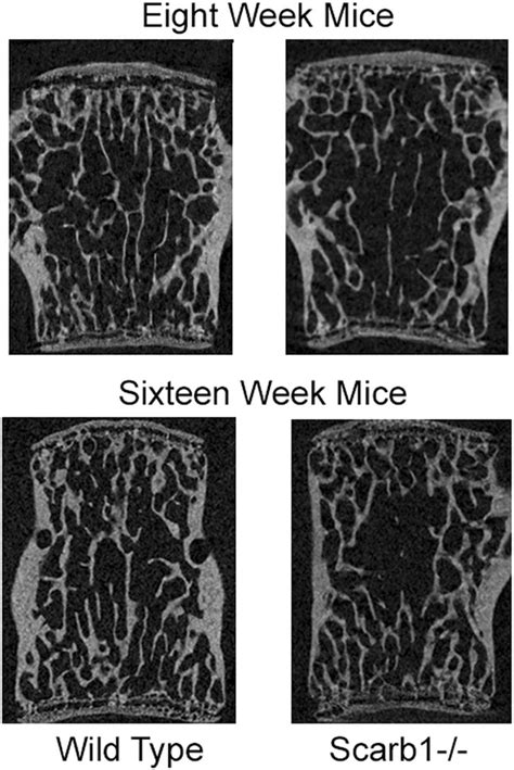 Appearance Of Vertebral Trabecular Bone At 8 And 16 Weeks Static