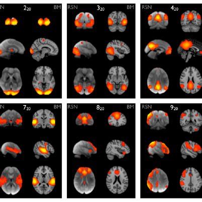 PDF FMRI For The Assessment Of Functional Connectivity