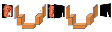 Polyp And Surgical Instrument Segmentation With Double Encoder Decoder