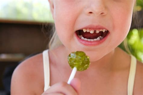 Caries Dental En Niños ¿cómo Prevenirla Mejor Con Salud