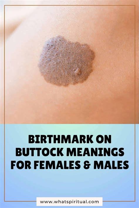 Birthmark On Buttock Meanings For Females And Males What Spiritual