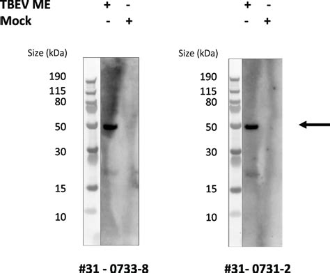 Immunoblotting Of Colostrum Samples Tbev Membrane M And Envelope E
