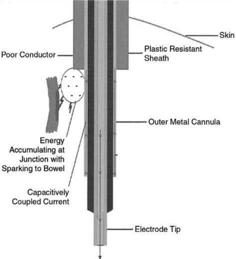 Surgical Energy The Operative Review Of Surgery