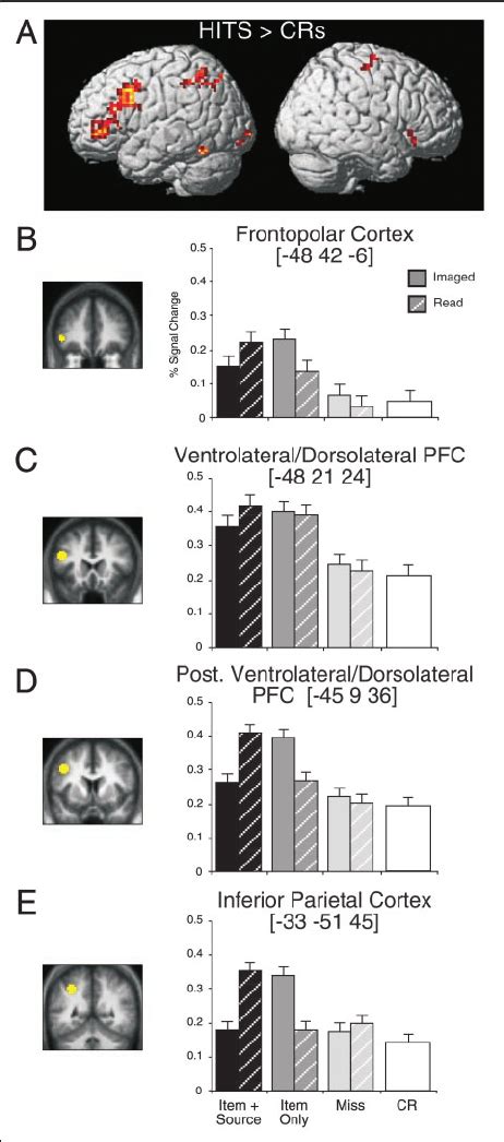 Left Frontal And Parietal Cortices Showing An Oldnew Effect And