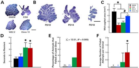 viruses special issue lcmv a pillar for immunology research