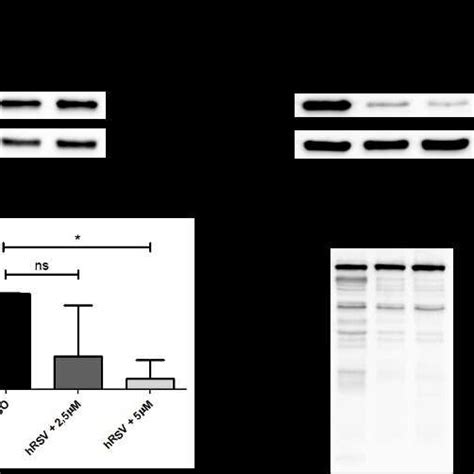 Effects Of Npm1 Oligomerization Inhibitor Nsc348884 On Hrsv Protein
