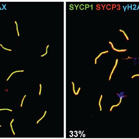 Sex Body Formation In The Prdm9 PWD 2 F 1 Hybrid Male Surface Spread Download Scientific