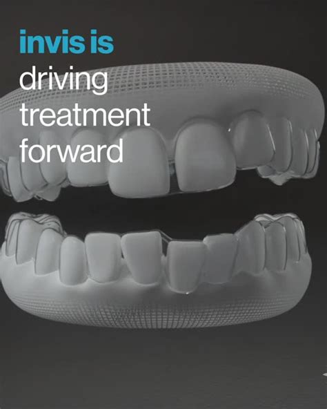 Steve Lebow On Linkedin Incorporating Alignment Into Treatment Plans Is Easy And Minimally Invasive