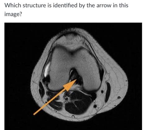 Unit 6 Flashcards Quizlet
