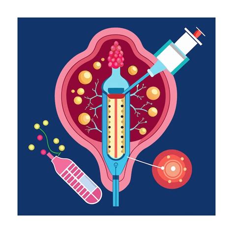 Hormonal Devices And Methods Concept Vector Illustration Premium Ai Generated Vector